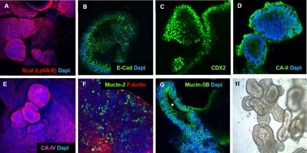 3dGRO™ Human iPSC Derived Colon Organoids | SCC300